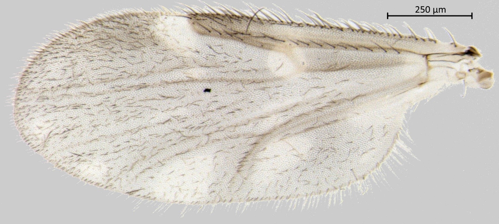 Culicoides (Diptera: Ceratopogonidae) of Ontario: A Dichotomous Key and ...